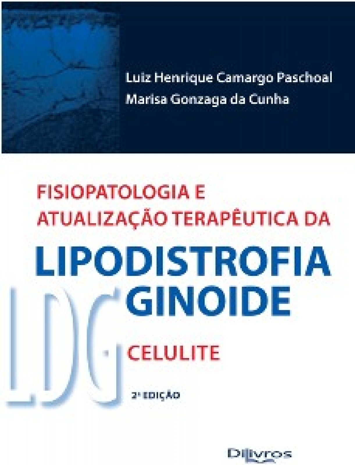 Fisiopatologia E Atualização Terapêutica Da Lipodistrofia Ginoide ...