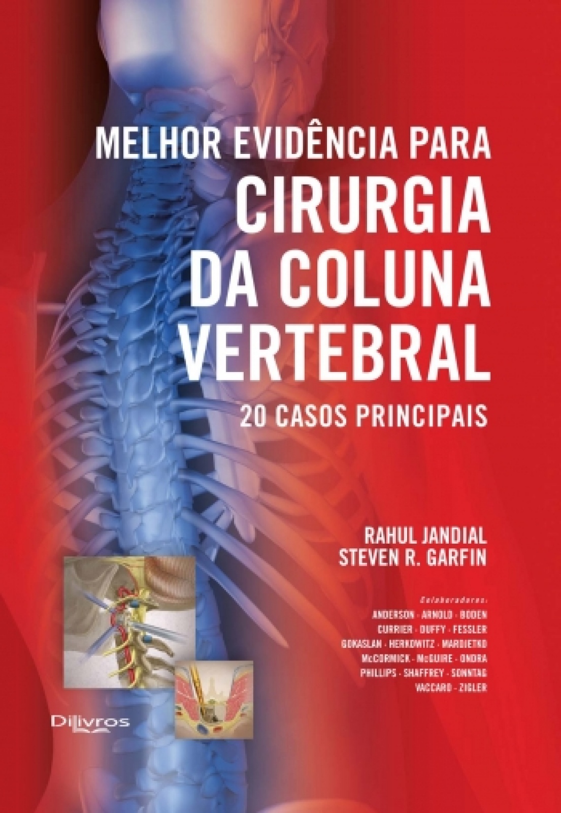 Melhor Evidência Para Cirurgia Da Coluna Vertebral - Doctor Livros - Um ...
