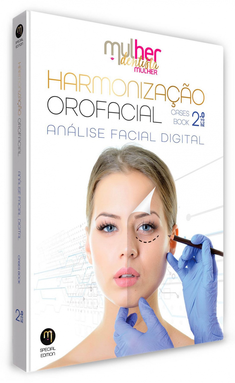 Harmonização Orofacial - Análise Facial Digital - Mdm Vol. 2 - Doctor ...